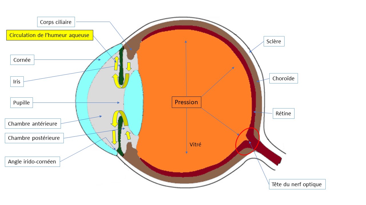 Le Glaucome - Rueil Ma Vision